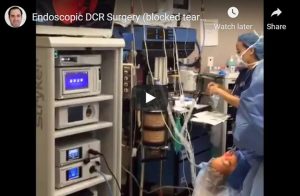 Lacrimal Tear Duct Eye Surgery Specialists Beverly Hills CA